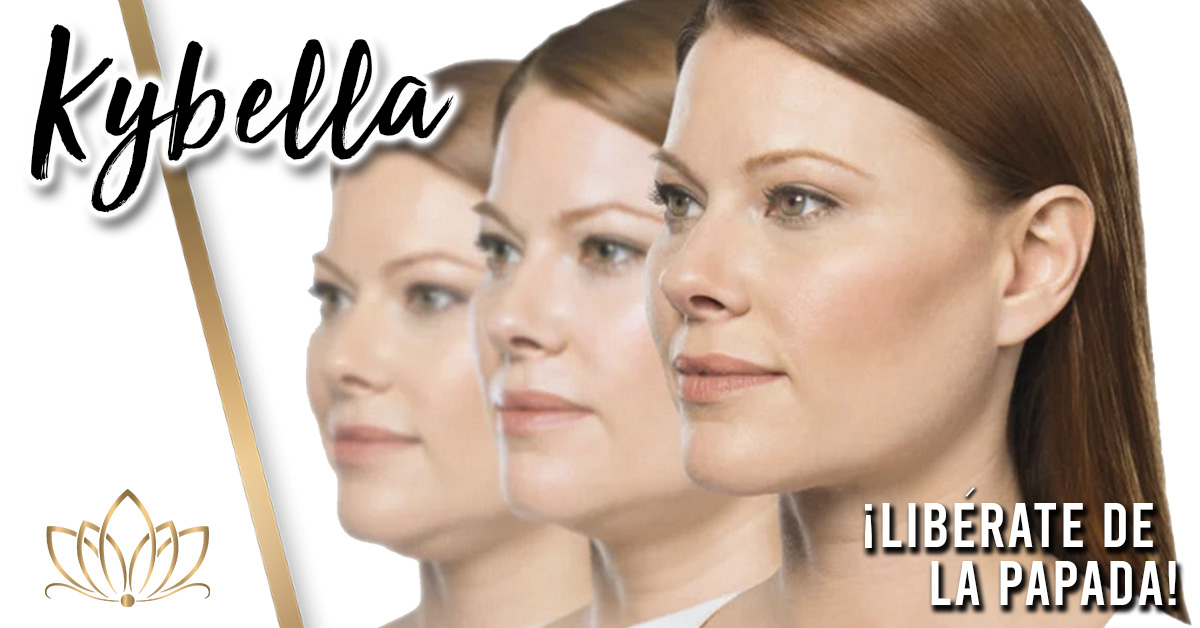 Kybella Tijuana - Vive Spa Medico Tijuana, Mexico