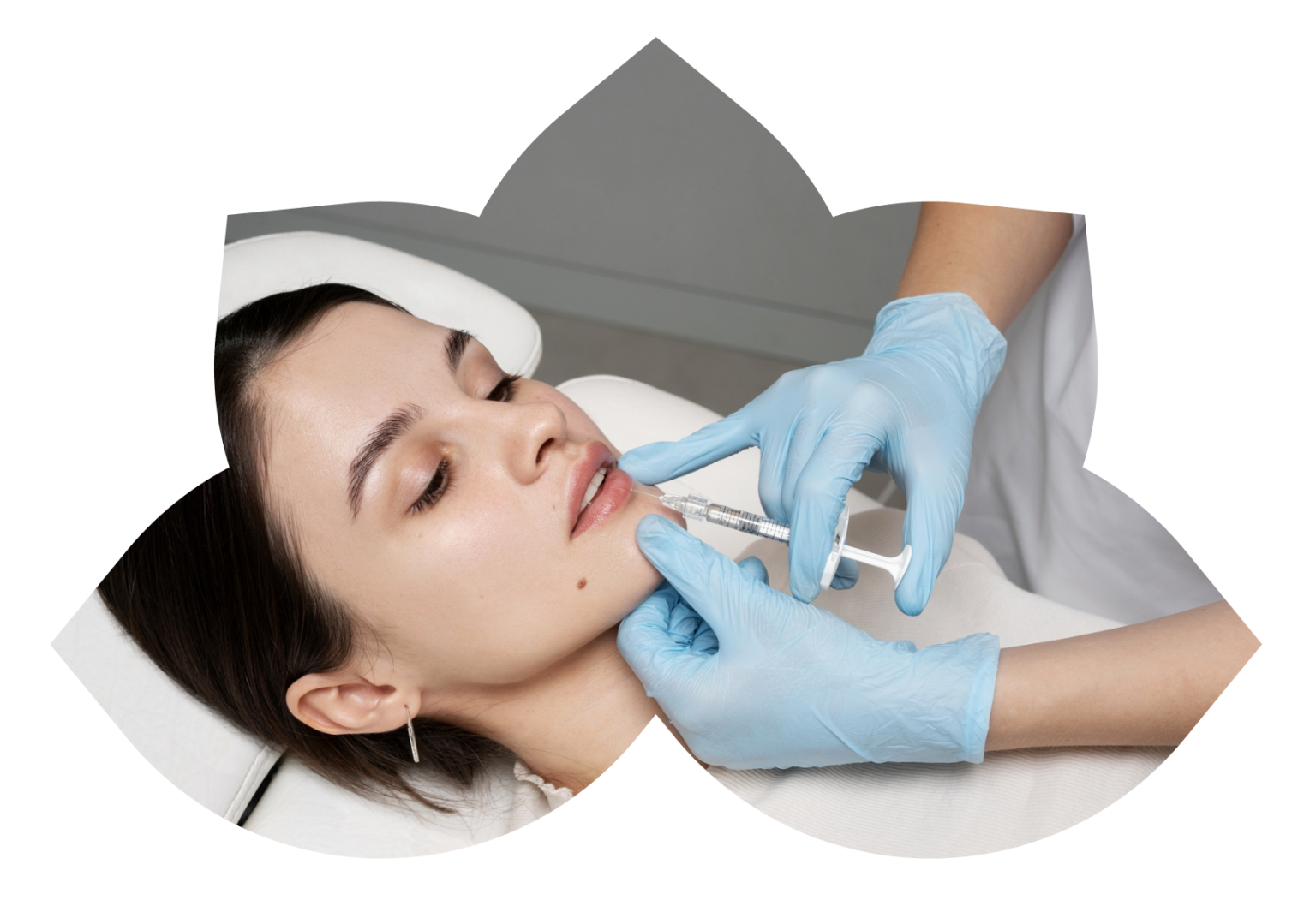 Landing Fillers - Vive Medical Spa