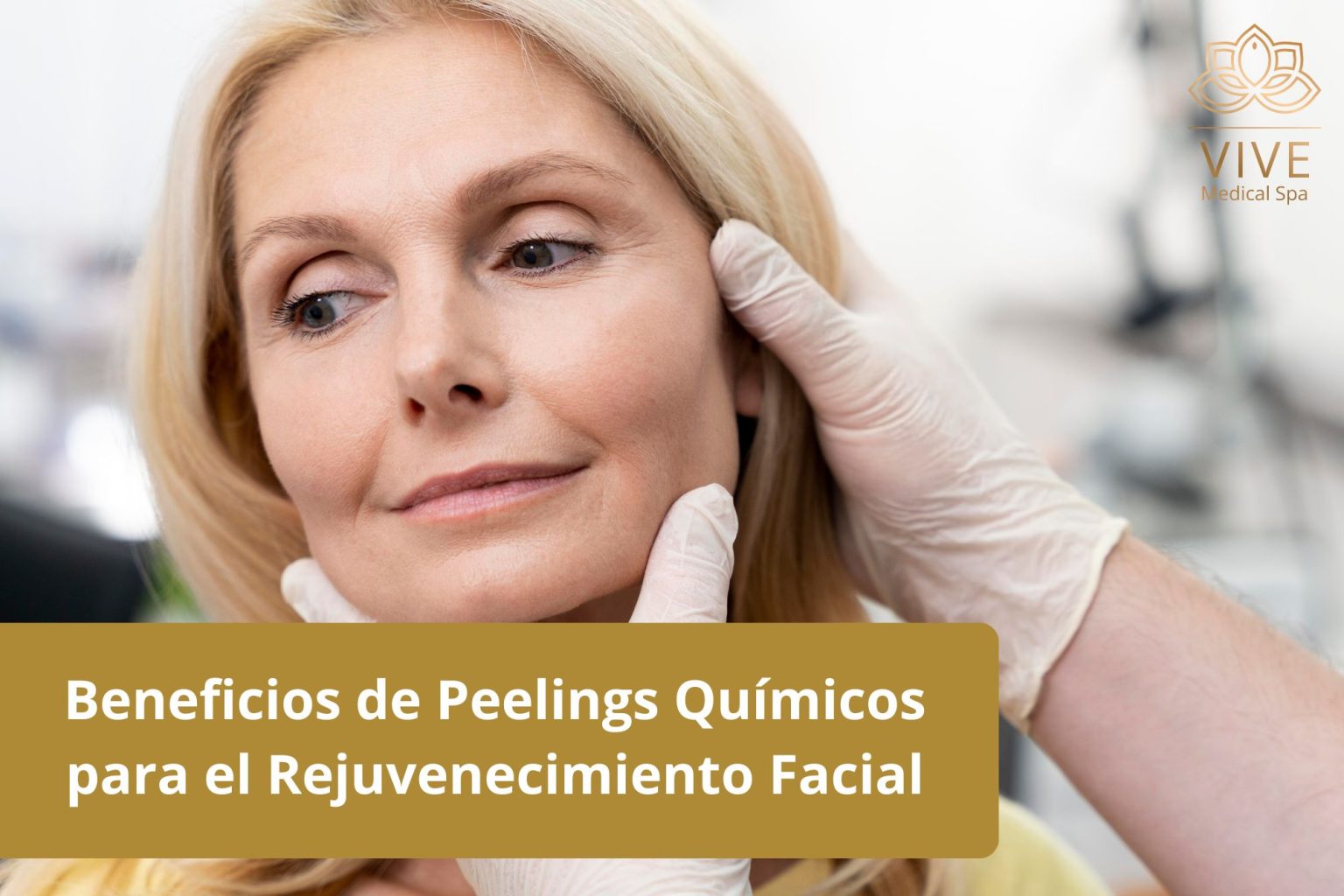 Beneficios de Peelings Químicos para el Rejuvenecimiento Facial